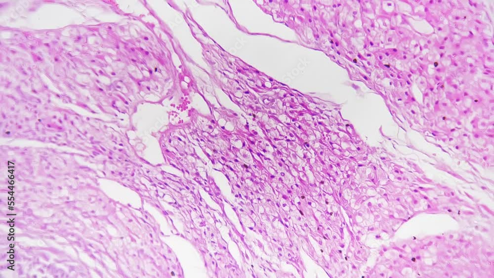 Stockvideon Woman ovary in section magnified under microscope in 400 ...