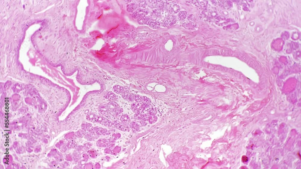 Wideo Stock: Mammary gland in stasis filmed under light micrograph with ...