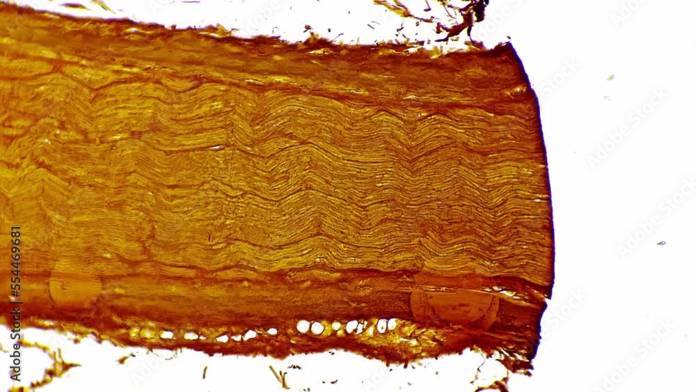 Silvering pattern of human nerves trunk in longitudinal section under ...
