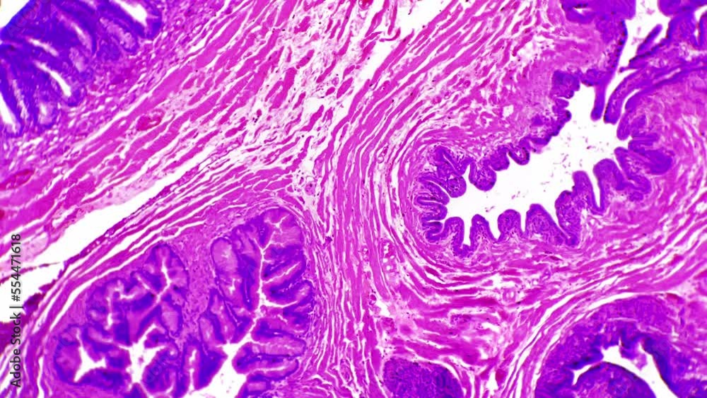 Human prostate gland in section magnified in 200 times against white ...