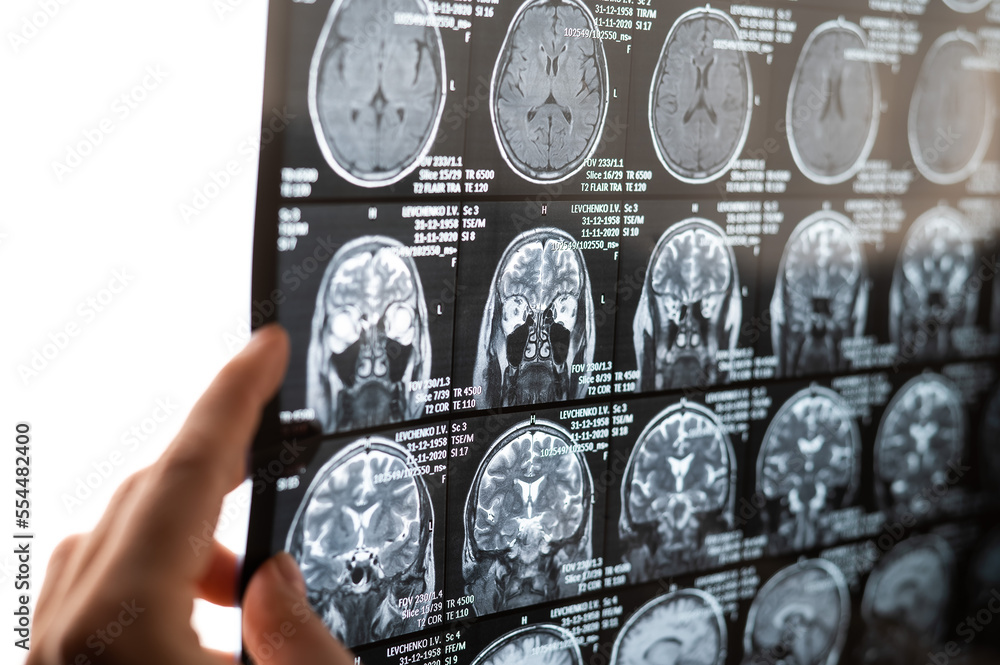 Poster A female doctor examines an MRI scan of the brain. – Wall Art ...