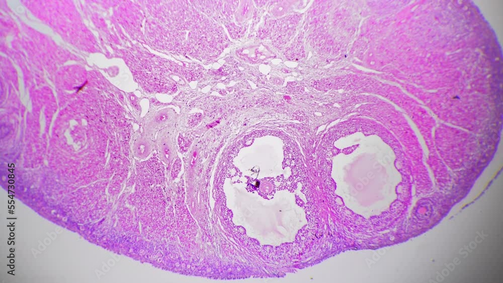 Human ovary in section magnified under microscope in 100 times against ...