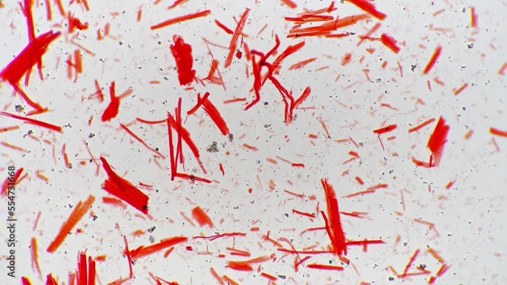 Micro pieces of human cardiac muscle in teased preparation whole mount ...