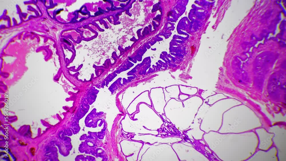 Microscopic magnification 100x of human prostate gland in section ...