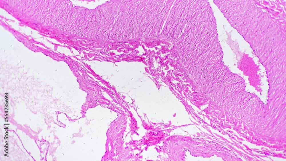 Human mammary gland secretion stage magnified in 200 times under ...