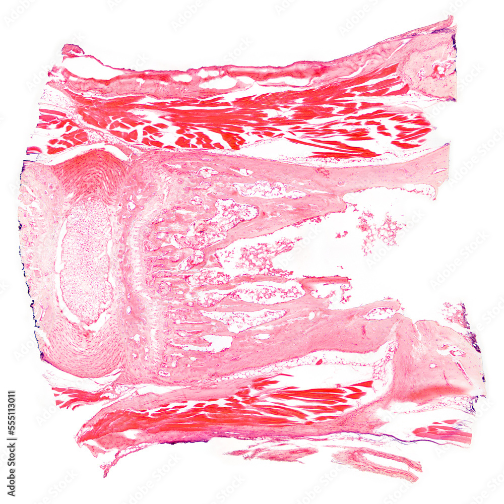 Tendon, section, 20X light micrograph. Piece of sinew, stained with ...