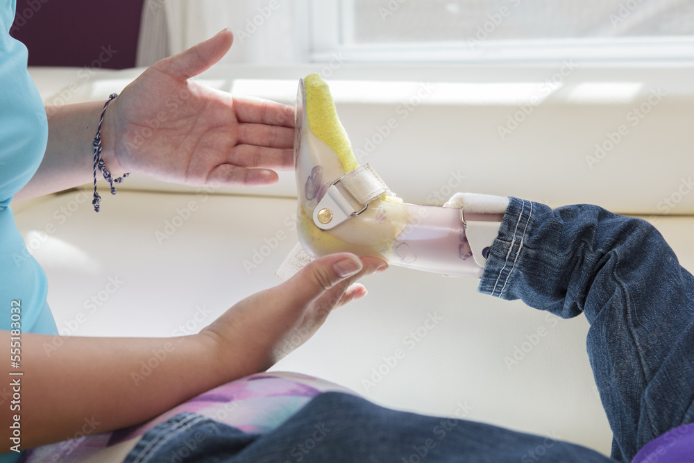 Mother putting leg brace on small daughter with Cerebral Palsy Stock ...