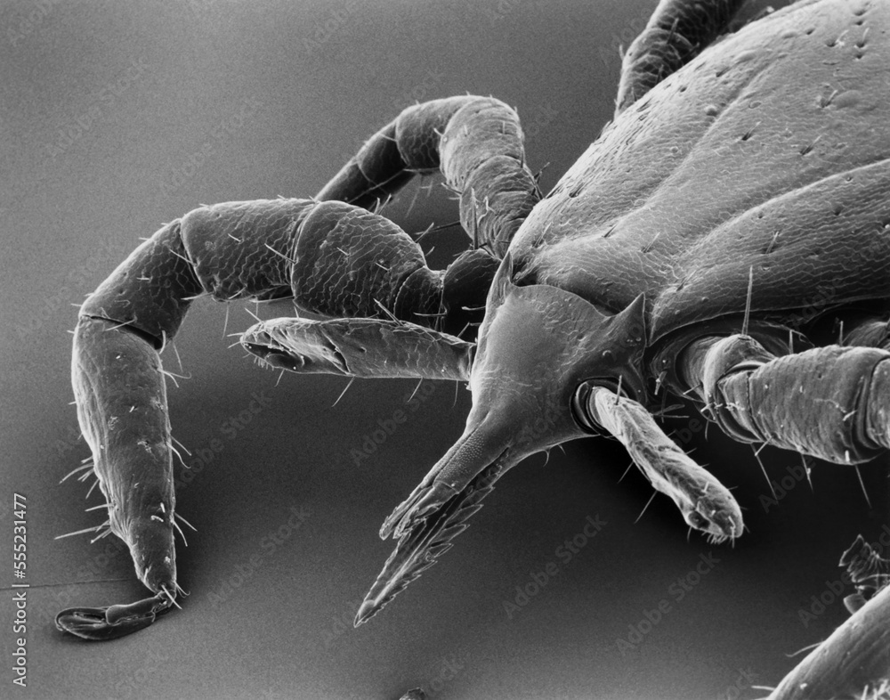 Microscopic view of a deer tick (Ixodes dammini) magnified about 90 ...
