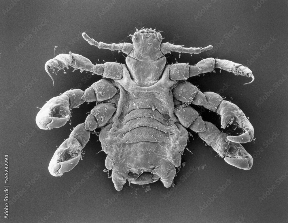 Scanning electron microscopic view of a crab louse (Pthirus pubis). It is magn ified 30x. It is ...