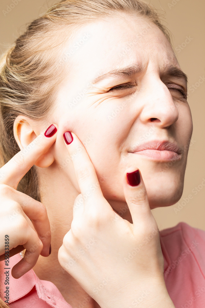 Skin Issues. Portrait of Young Emotional Caucasian Blond Woman With ...