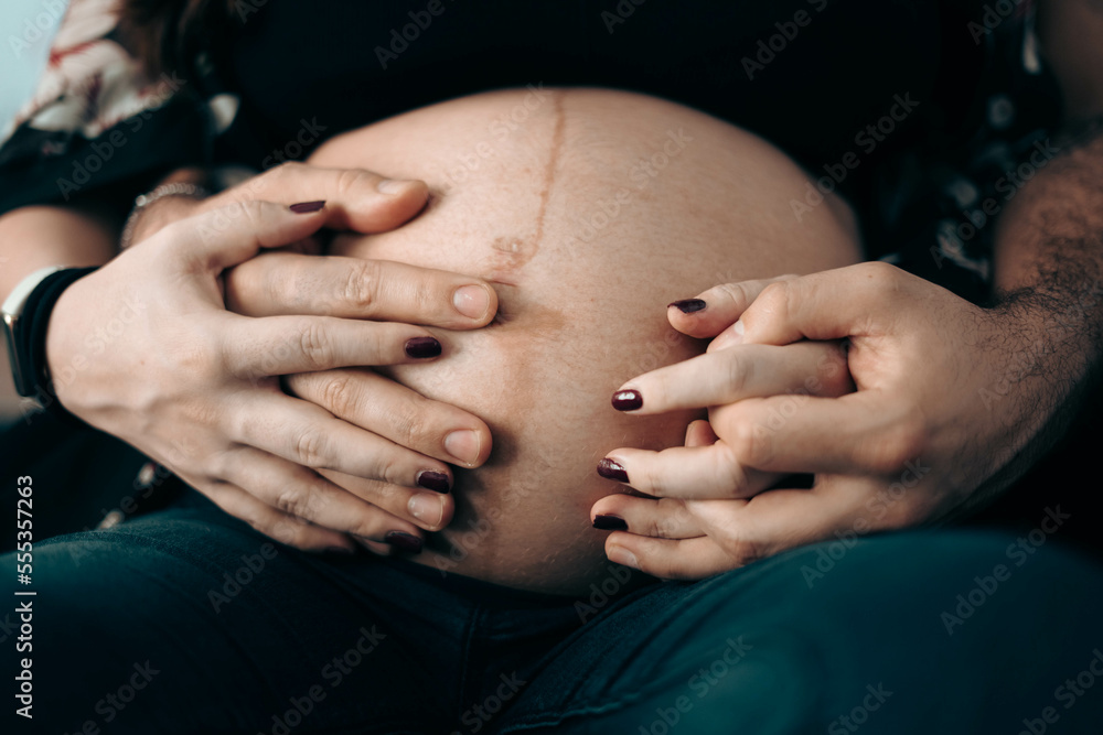 Hands of expectant parents caressing baby bump. Fingers intertwine as ...