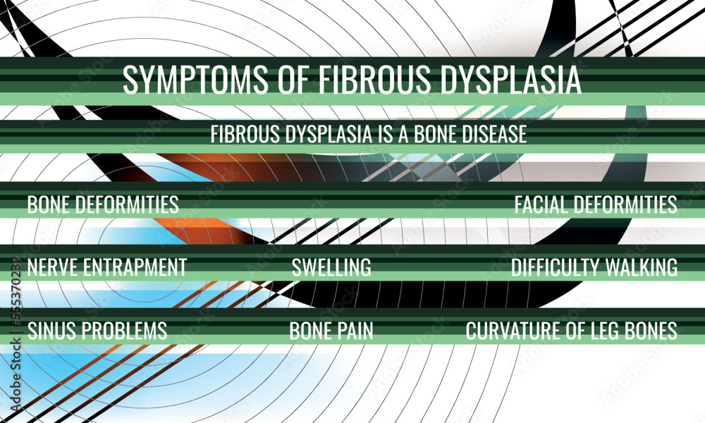 symptoms of Fibrous dysplasia. Vector illustration for medical journal ...
