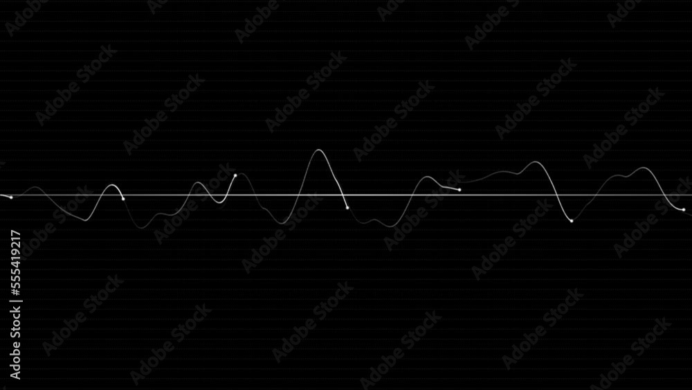 Electro cardiogram on any background with Alpha Channel. Moving ...