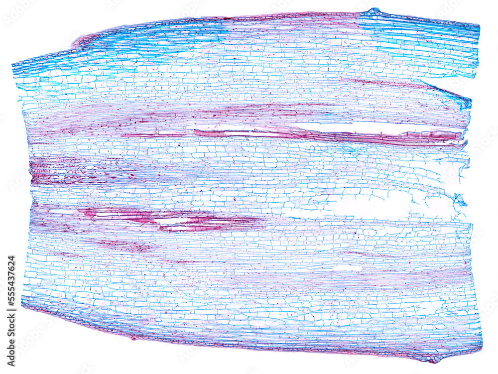 Sunflower stem, longitudinal section, 20X light micrograph. Stem of ...