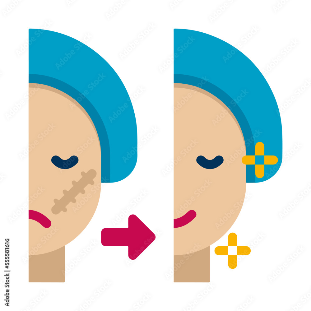 Vector realistic set of surgical sutures and scars, stitched wounds at ...