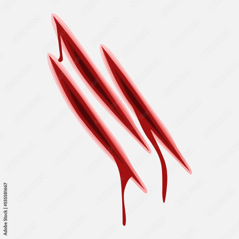 Vector realistic set of surgical sutures and scars, stitched wounds at ...