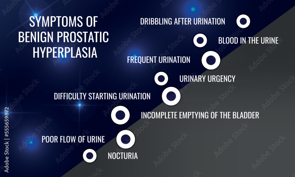 symptoms of Benign prostatic hyperplasia. Vector illustration for ...