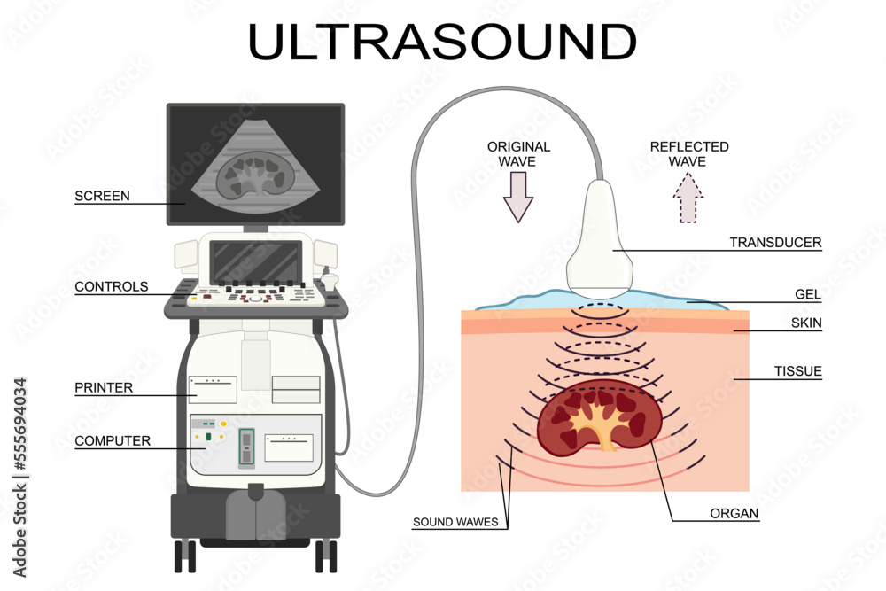 Ultrasound analysis equipment and process vector illustration ...