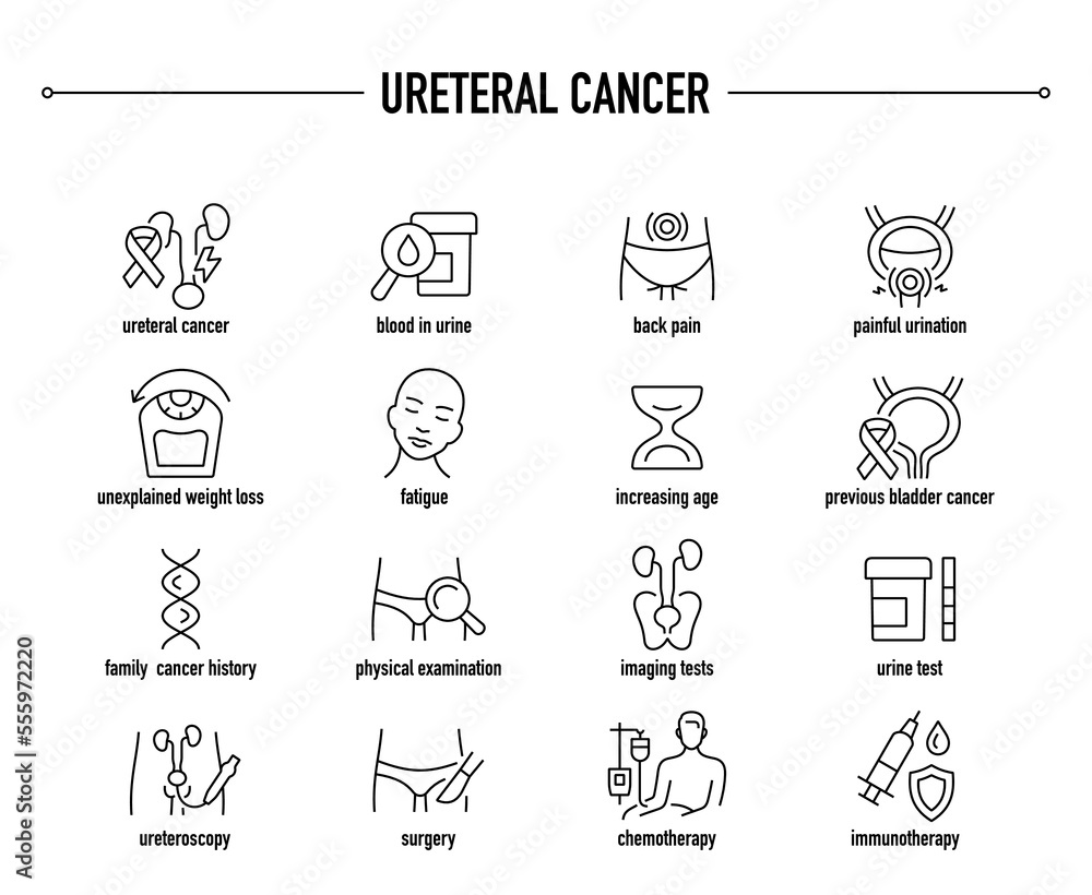 Ureteral Cancer symptoms, diagnostic and treatment vector icon set ...