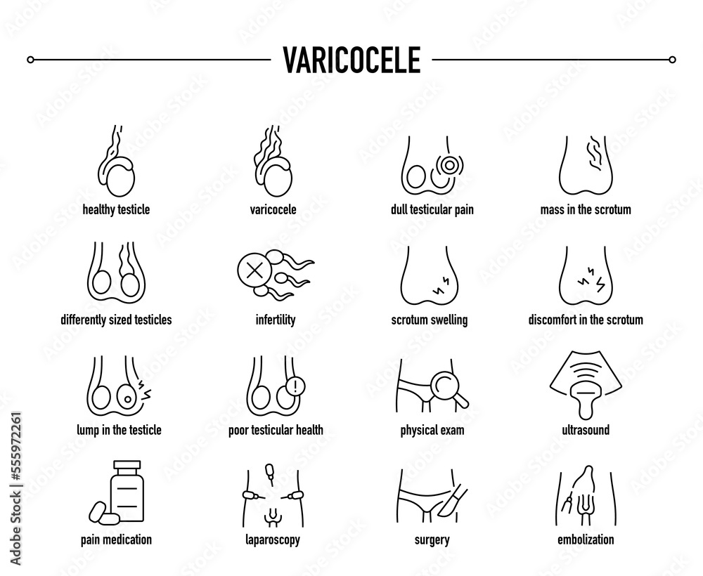 Varicocele symptoms, diagnostic and treatment vector icon set. Line ...