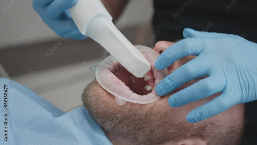 Close up: Doctor scans the teeth of a male patient in the medical ...