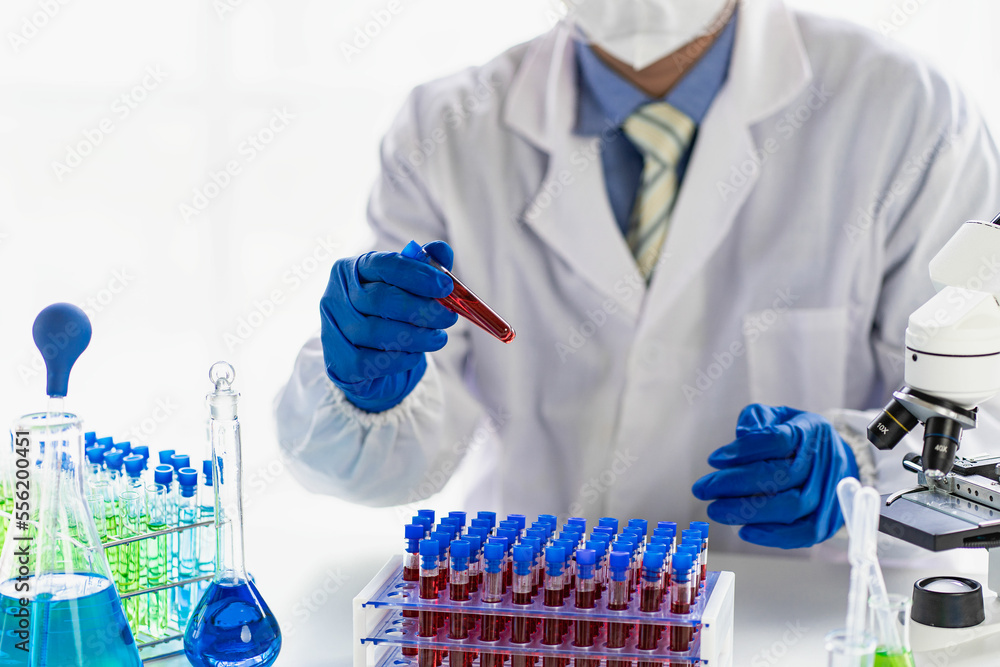 Professional doctor examining arterial blood sample, professional ...