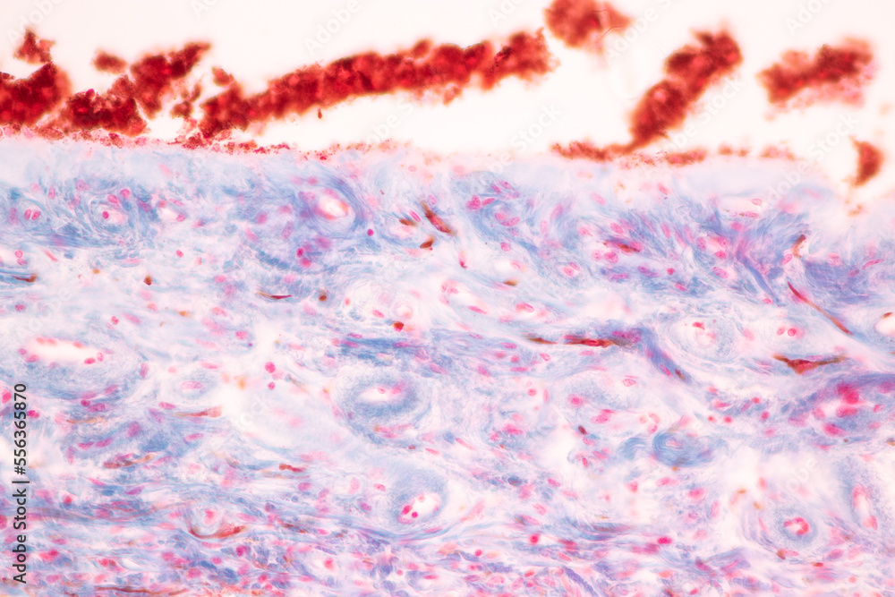 Characteristics Tissue of Optic nerve Human, Cornea from eye Human and ...