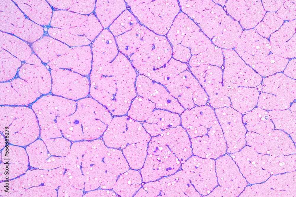 Characteristics Tissue of Optic nerve Human, Cornea from eye Human and ...