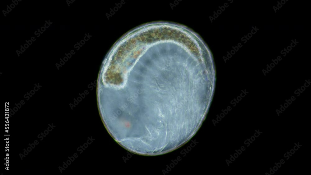 Formed embryo in an egg Amphipoda crustacea under the microscope ...