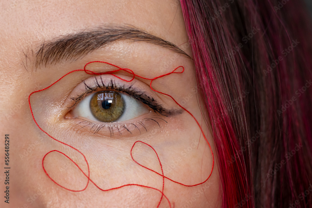 The concept of red and blue spider veins and dilated eyelids around the ...