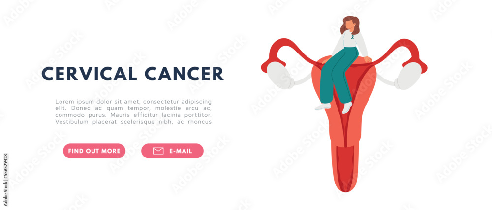 Cervical cancer concept. Disease symptom. HPV infection development ...