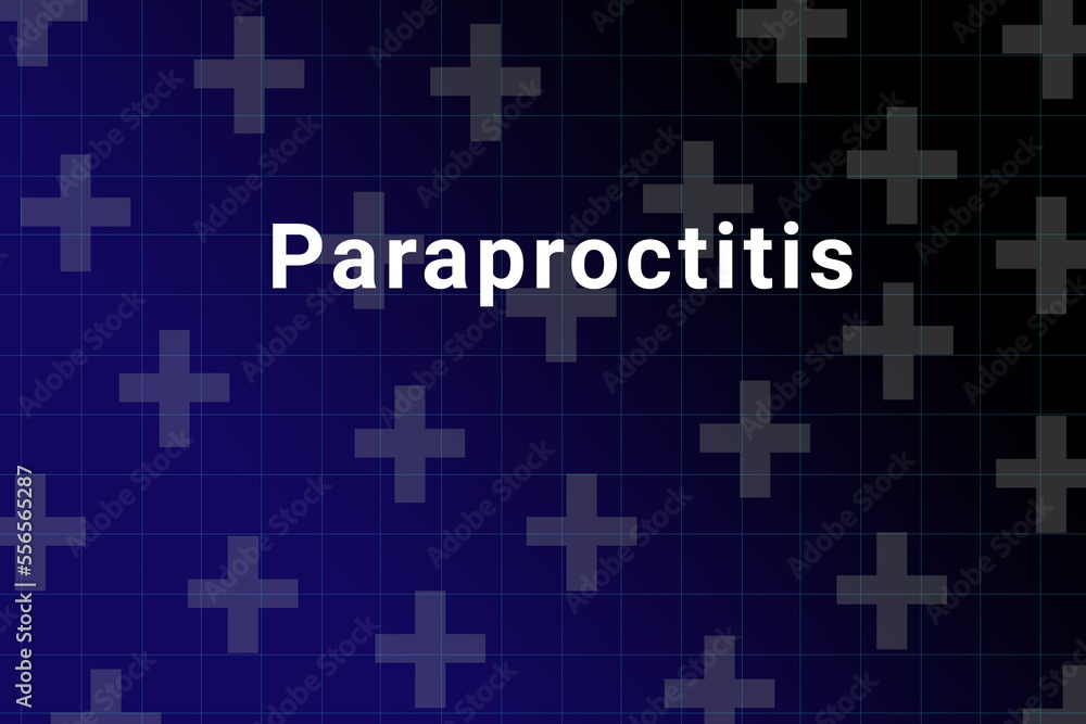 Paraproctitis disease Illustration. Paraproctitis title on medical ...