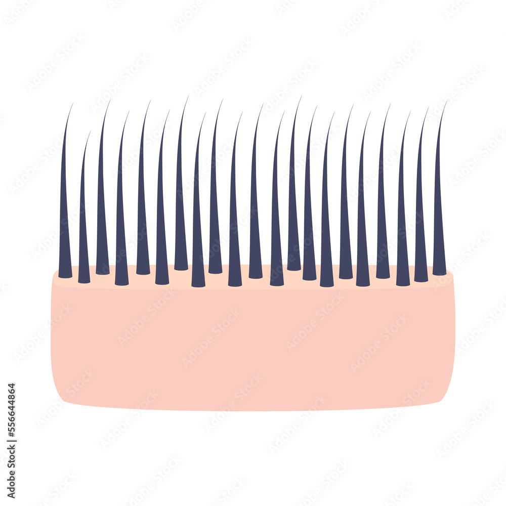 Normal hair thickness type. Skin cross-section with thin strands ...