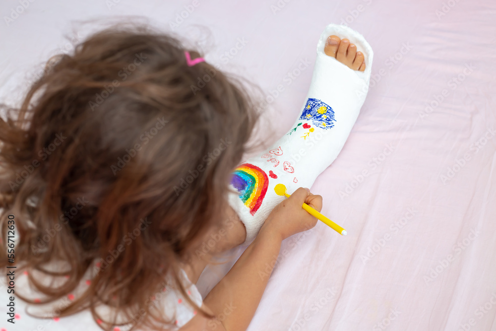 The child's leg is broken. A unrecognizable little girl of 10 years old ...