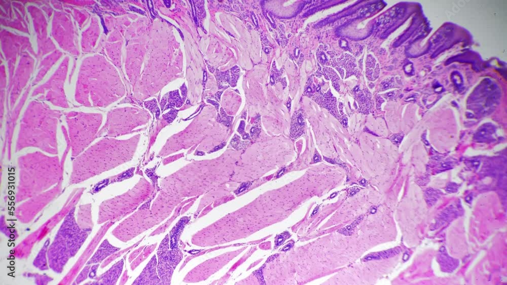 Human palatine tonsil filmed under microscope with high magnification ...