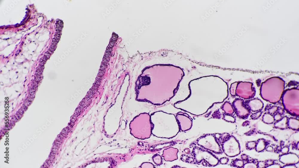 Vídeo do Stock: Human parathyroid cells in section filmed with high ...