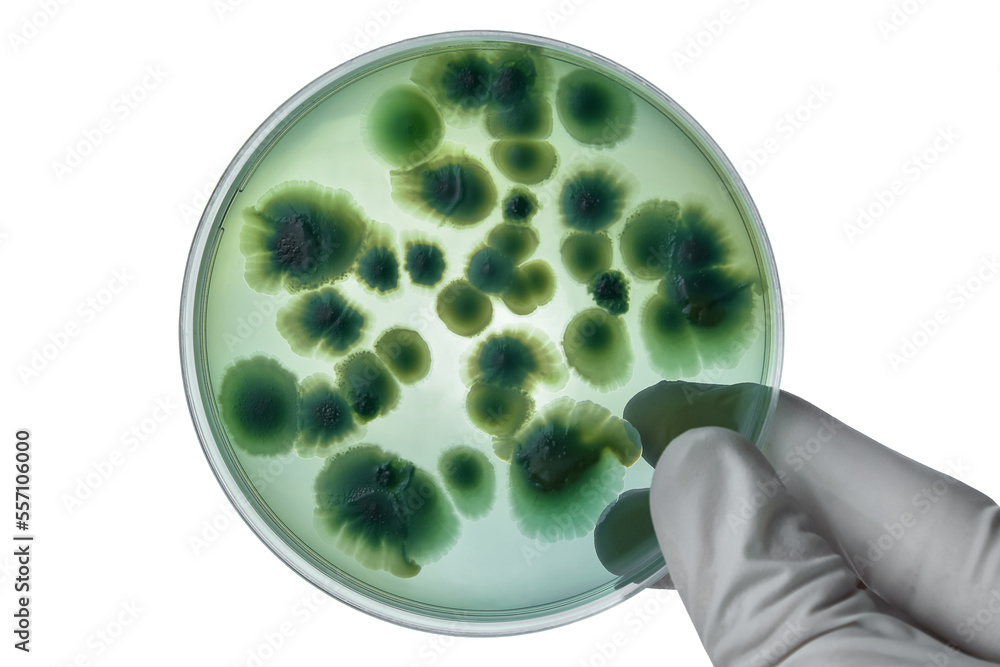 Hand with Petri dish or culture media with bacteria on white background ...