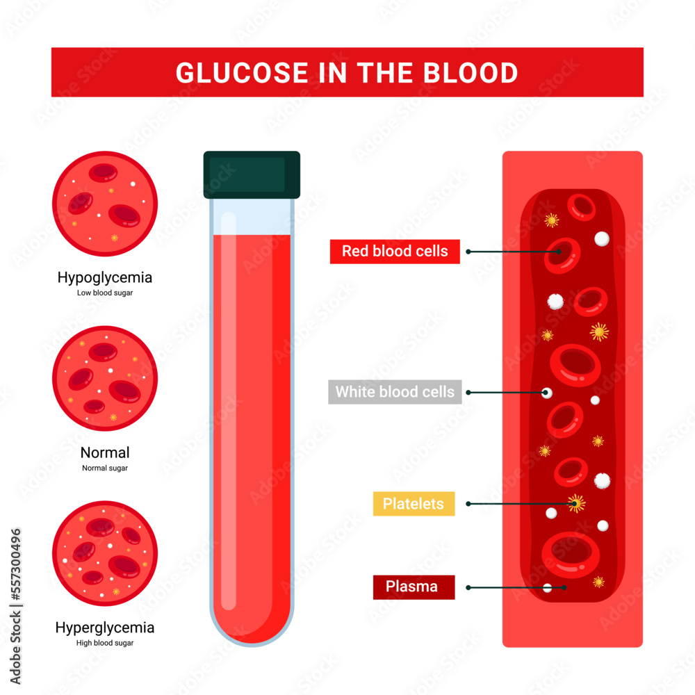 Glucose blood infographics, human level glucose vector Stock Vector ...
