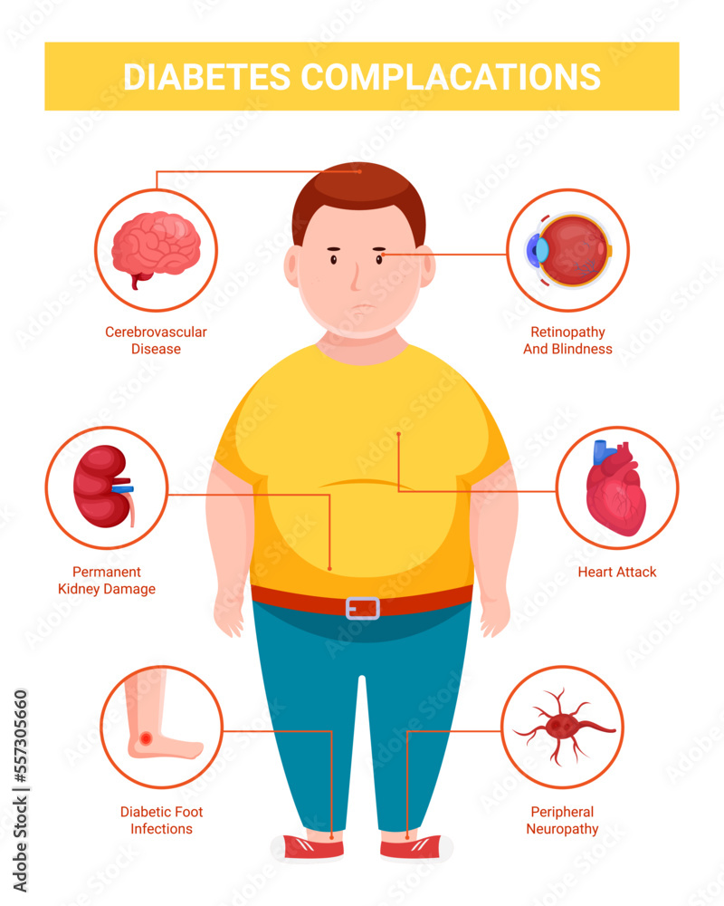 Diabetes complications infographic, illustration of a man with diabetes ...