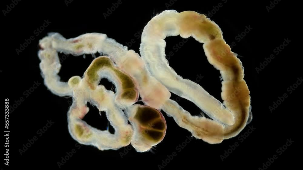 Damaged worm of the family Oweniidae under a microscope, possibly ...