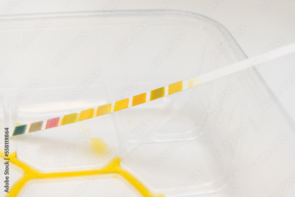 urine sample with test strip waiting for evaluation Stock Photo | Adobe ...