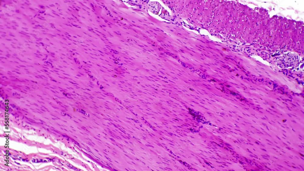 Section of human duodenum filmed under microscope with 100x ...