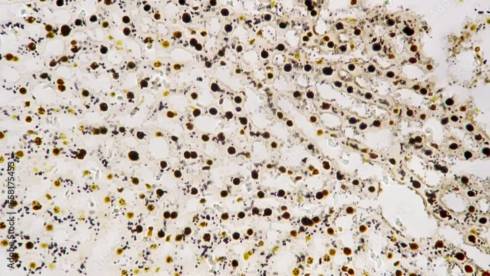 Human cholangiole in section under microscope with 400x magnification ...