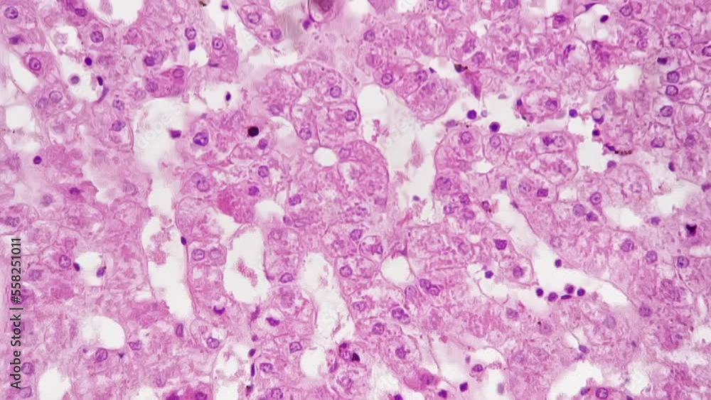 Section of human liver under microscope with 400 times magnification on ...