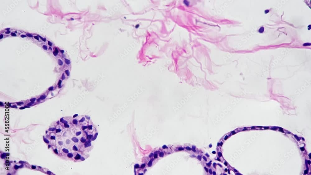Thyroid gland of the human in section filmed under microscope 400x ...