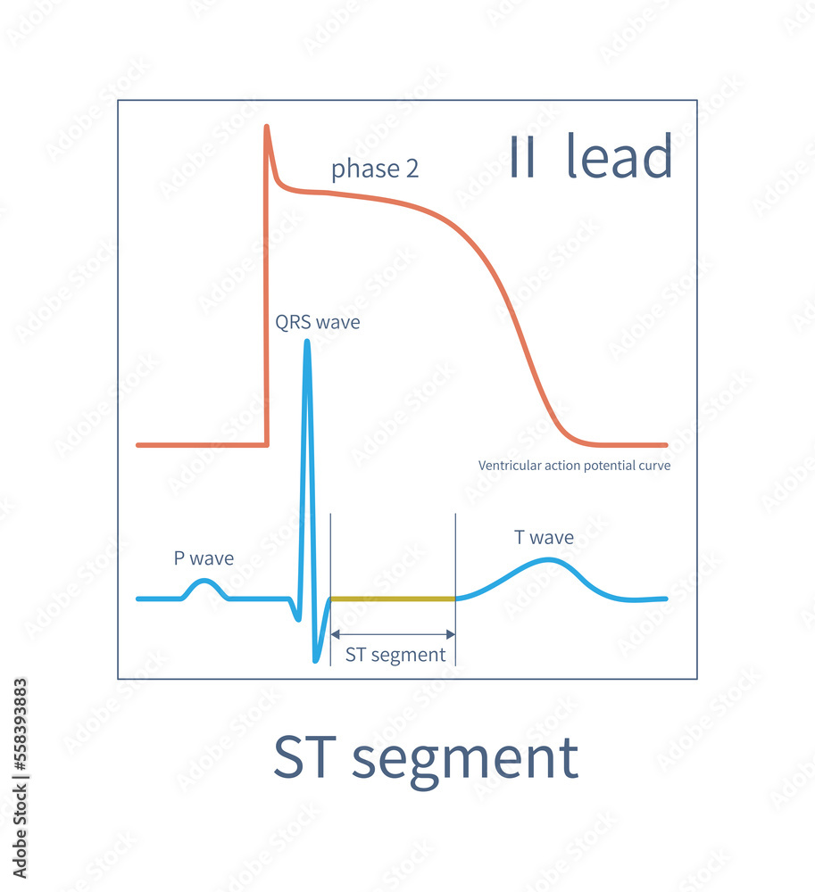 The St Segment Of The Ecg Is Equivalent To The Second Phase Of The Ventricular Muscle Action