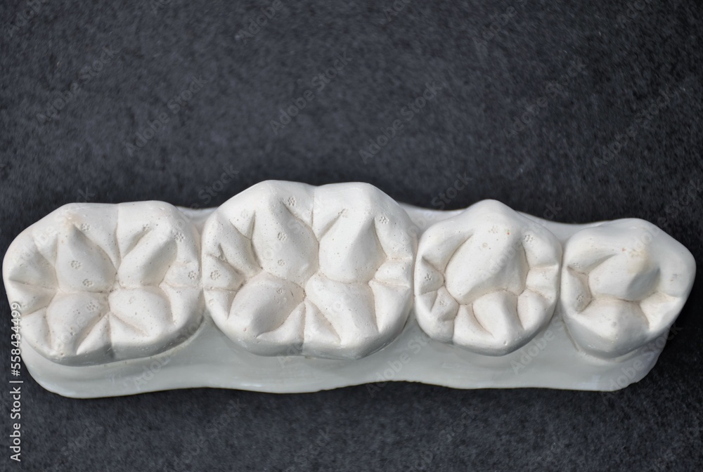 Mandibular premolars and molars in white plaster on a dark background ...