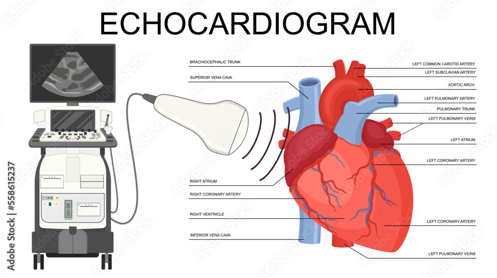 Echocardiogram. Heart ultrasound. Medical Vector Human Heart ... Echocardiogram. Heart ultrasound. Medical Vector Human Heart ...