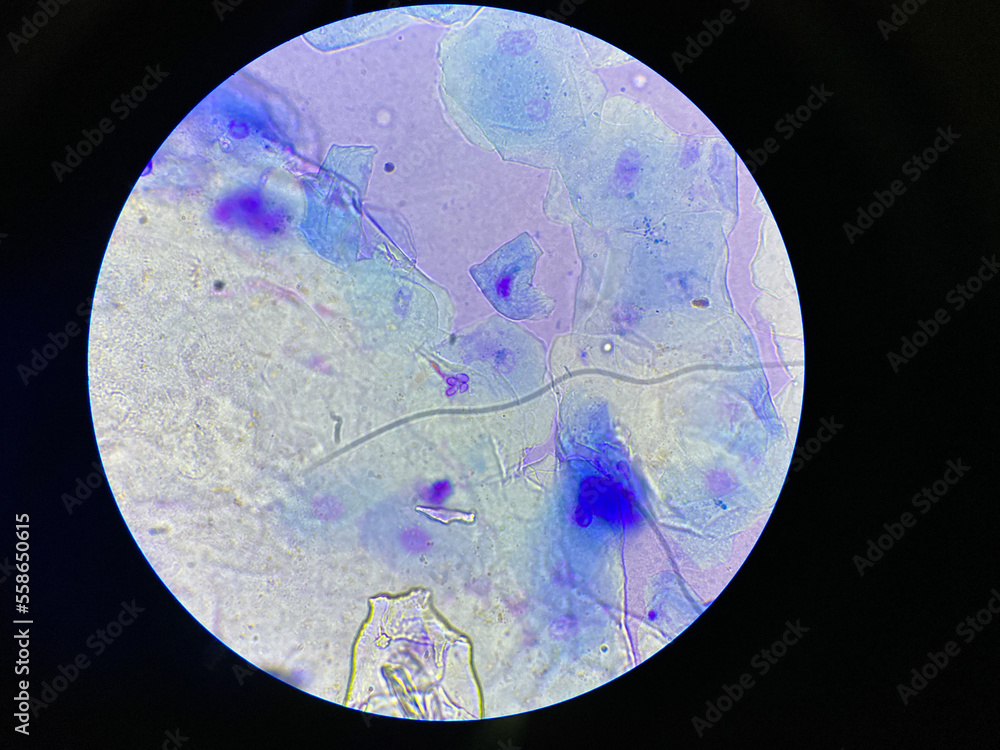 Microscopic view of Malassezia pachydermatis cells taken from dog with ...