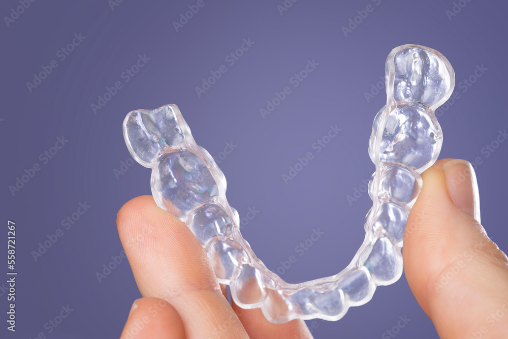dental hygiene, orthodontic treatment, occlusal splint Stock Photo ...